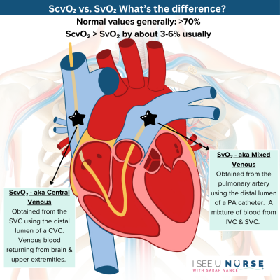 Right and Left Heart Differences - ISeeU_Nurse with Sarah Vance